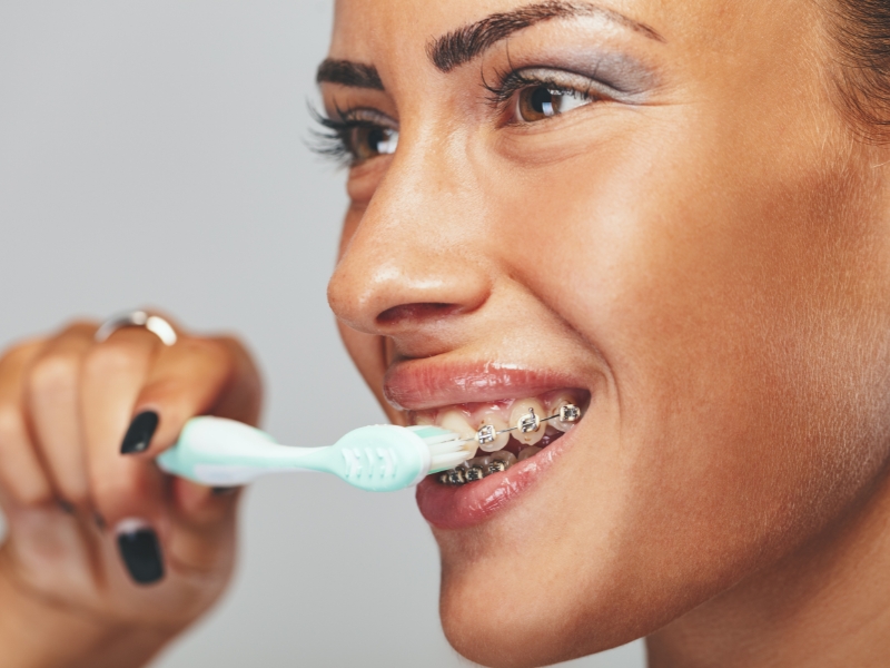Dental Hygiene - Springer Orthodontics
